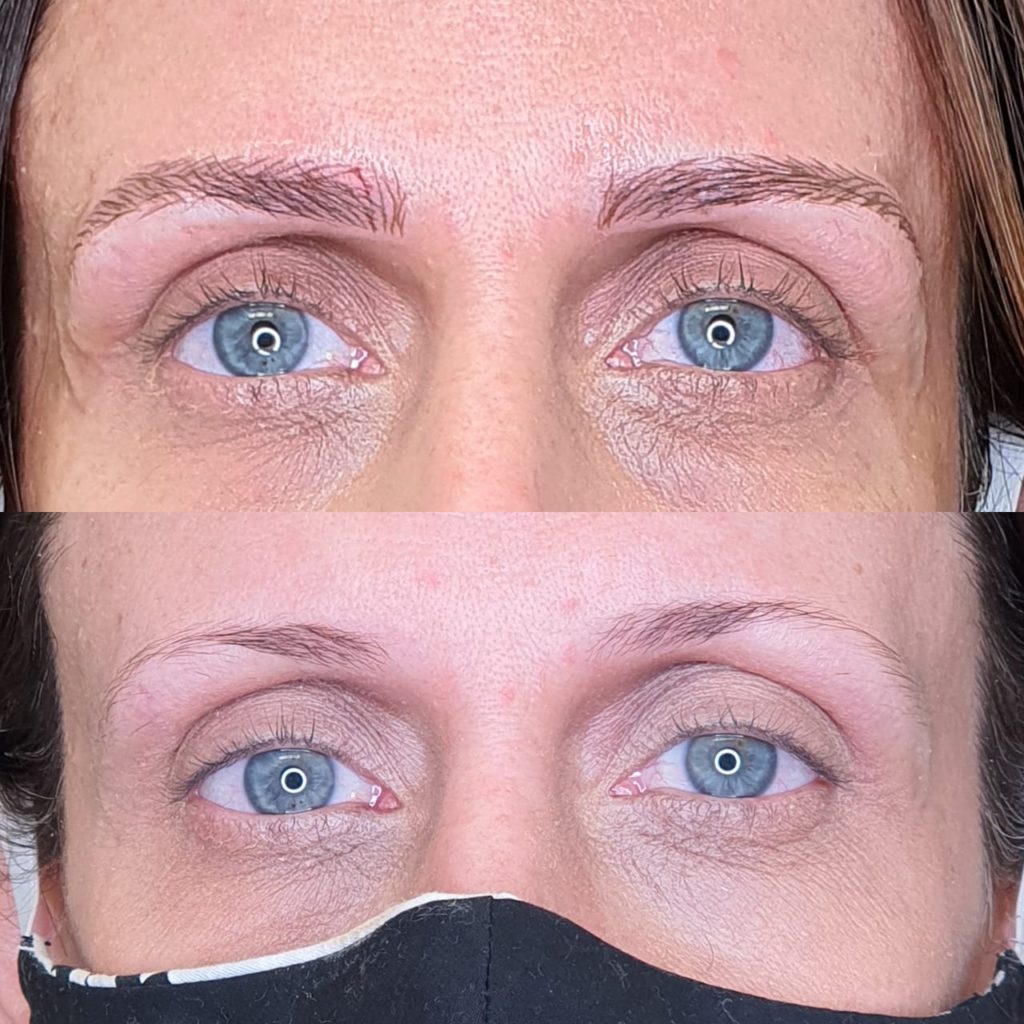 3 antes e depois que mostram o poder da microblading – Majestic